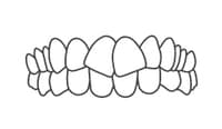 Invisalign Dentist Mountain Home AR - Dover Family Dentistry